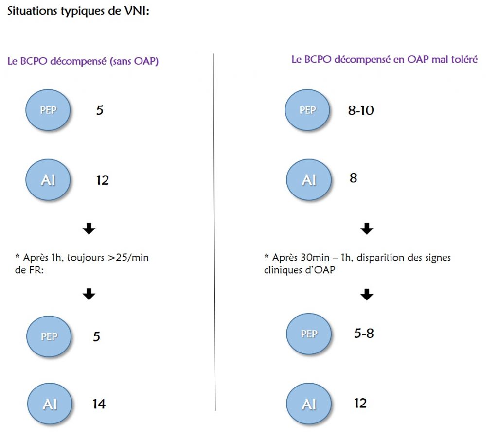 Oxygénation et VNI aux urgences pour les nuls | La Mine